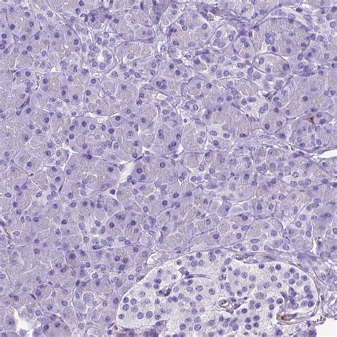 Rabbit Polyclonal Anti Apoe Antibody Buy For Research Highly Specific Rigorously Validated