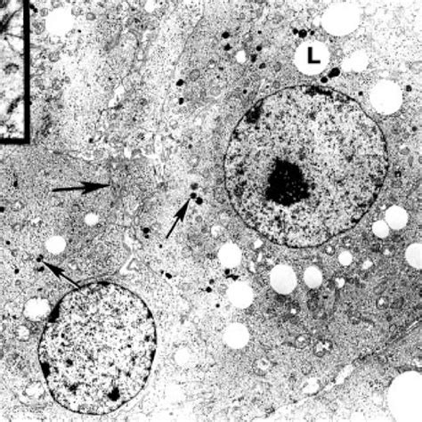 Stage 1 Luteal Cells A Upper Panel Large Luteal Cell With