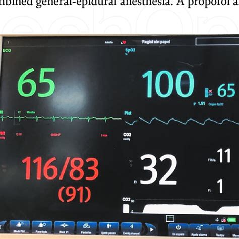 Standard Asa Monitoring American Society Of Anestesiologists