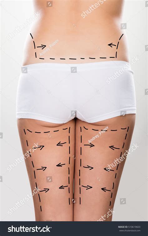 Closeup Woman Correction Lines On Her库存照片510619603 Shutterstock