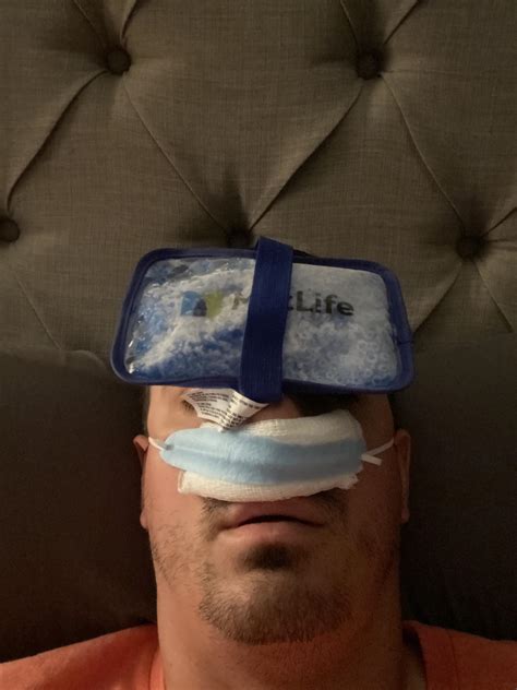 Sinus Surgery Bloody Mucus Thick Wrap Splints In Nostrils And Still