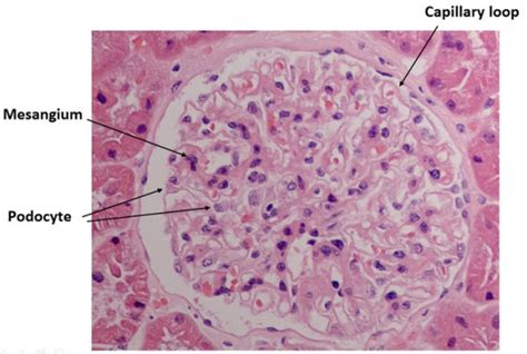 Normal Glomerulus The Hku E Learning Platform In Clinical Medicine