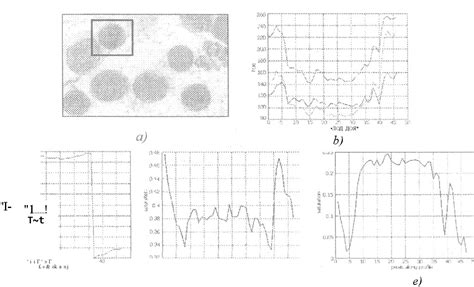 Figure 1 From Thyroid Cells Extraction Using New Componentwise