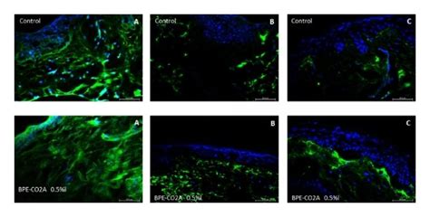 Extracellular Matrix Elements Evaluation A Collagen And Elastin