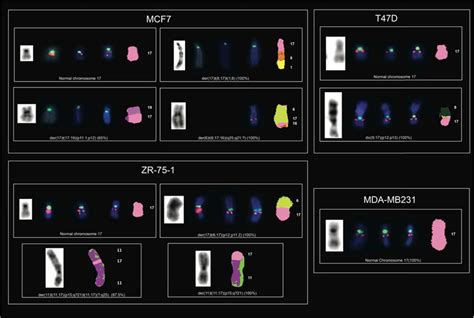 Analysis Of Chr17 Using G Banding Dual Color Fish Her2cep17