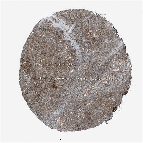 Tissue Expression Of Ednra Staining In Ovary The Human Protein Atlas