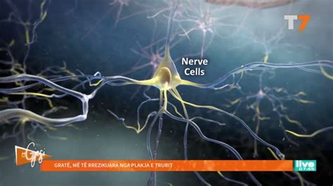 Gjesi Gratë Më Të Rrezikuara Nga Plaka E Trurit Gjirafavideo
