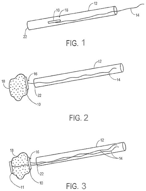 System And Method For A Tissue Resection Margin Measurement Device Eureka Patsnap