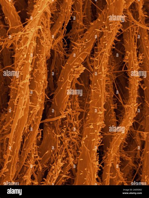 Coloured Scanning Electron Micrograph Sem Of Filamentous Iron Oxidizing Bacterium Leptothrix