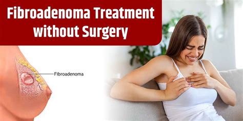 Fibroadenoma Treatment Without Surgery Natural Alternatives