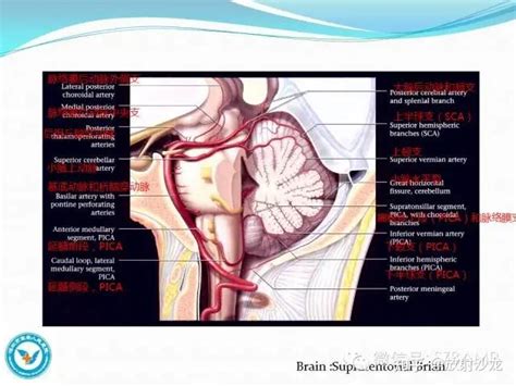 椎 基底动脉系统ct，mr及dsa影像解剖 知乎