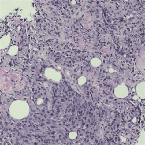 Enlarged Lymph Nodes In The Inguinal Area See Arrow Download Scientific Diagram