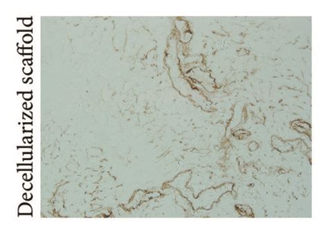 Analyzation Of Ecm Components A B Hande Staining Of The Normal Download Scientific Diagram