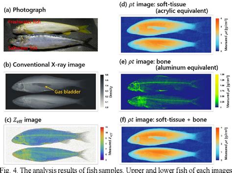 Figure 4 From Bone And Soft Tissue Images Extraction Through Derivation Of Effective Atomic