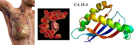 Depistare Marker Tumoral Ca 15 3