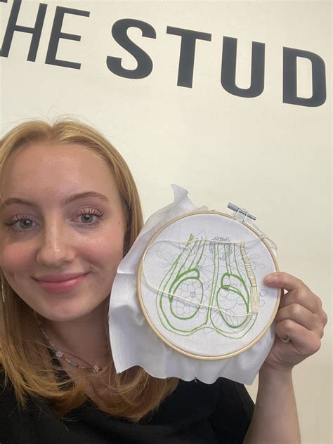 Orchitis Vs A Healthy Testicle Human Steam