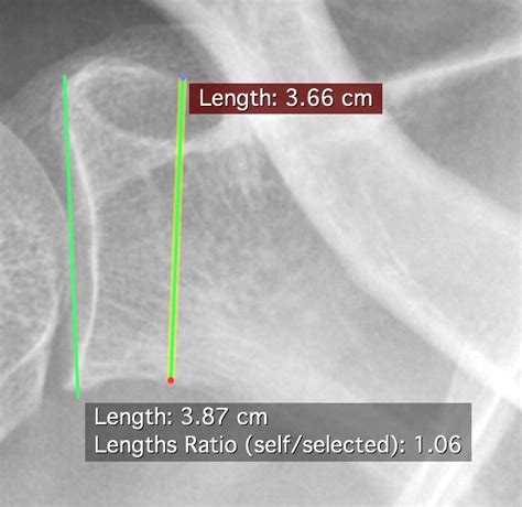 Osirix Dicom Viewer Osirix 70 Release