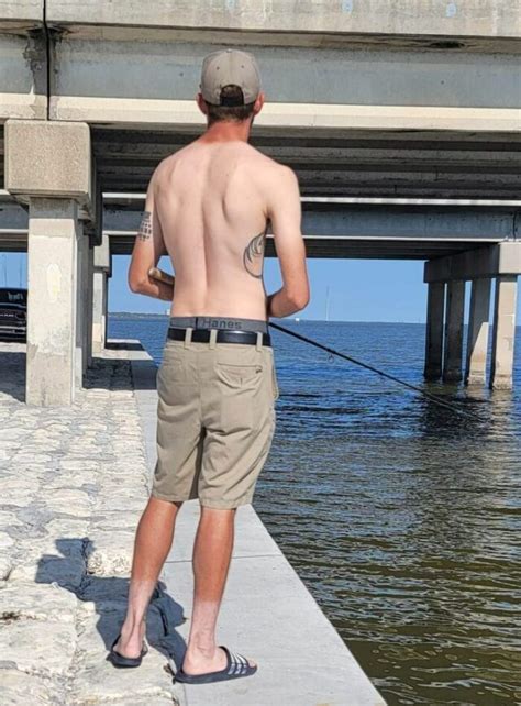 25 Hilarious Sunbathing Fails That Will Make You Think Twice About