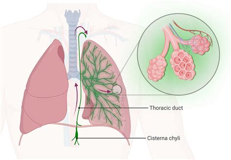 Pulmonary Lymphatic Perfusion Syndrome Illustration Shows Abnormal Download Scientific Diagram