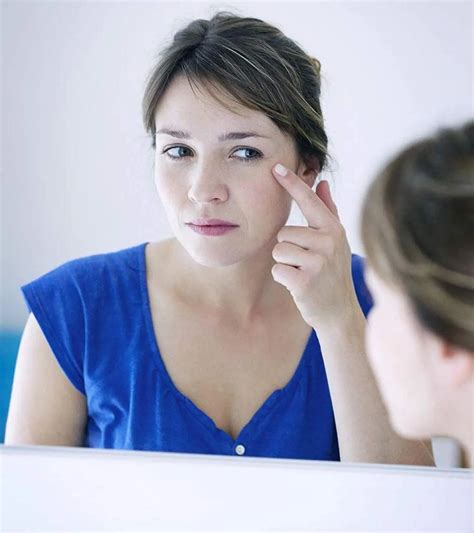 How To Get Rid Of Crows Feet 11 Ways And Prevention Tips