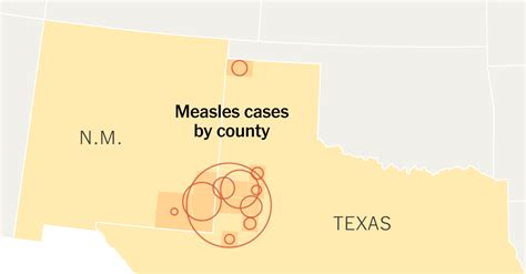 Tracking Measles In The U S Latest Maps And Cases The New York Times