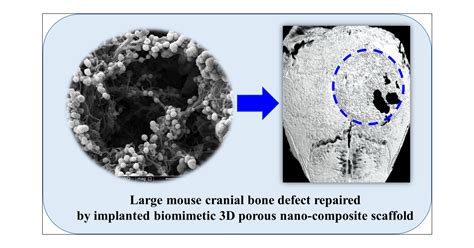 Biomimetic Nanofibrous 3d Materials For Craniofacial Bone Tissue