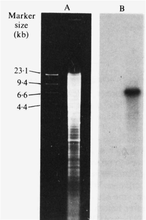 Restriction Map Of A The Plasmid Clone Pjwl And B The Plasmid