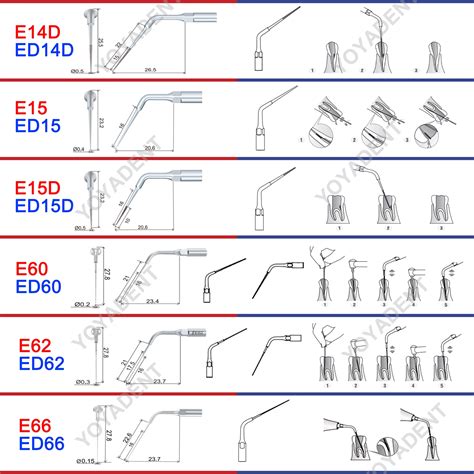 Generic Woodpecker Dte Endo Tips Ultrasonic Scaler Tips Scaling Tips Ed