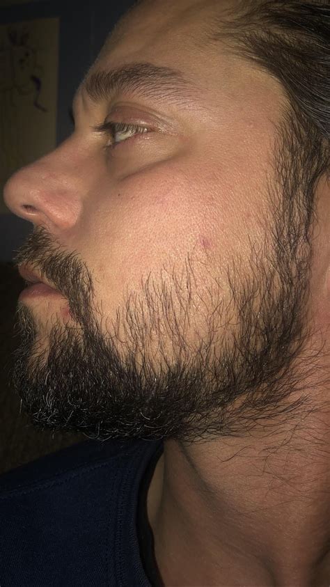 38 Years Old Very Patchy Weak Beard It S Three Four Weeks In Now