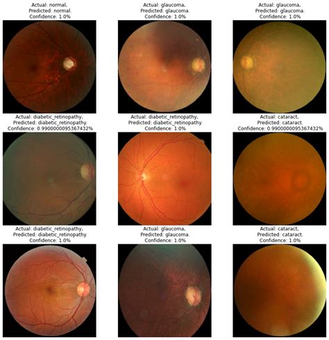 Github Mohamedbakrey12 Classification Eye Diseases And Deployment