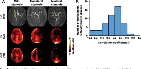 Figure 1 From Cerebrovascular Reactivity Mapping Using Resting State