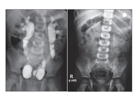 Ivu Radiology And Imaging Urogenital Contrast Ppt