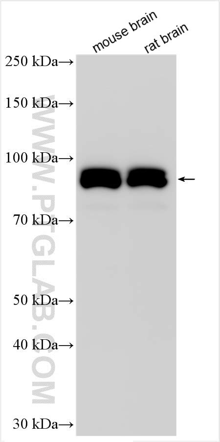 Rasgrp1 Antibody 26997 1 Ap Proteintech