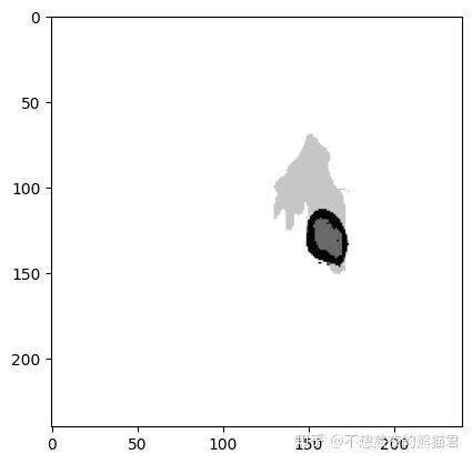 医学图像处理一simpleitk打开查看nii图像 知乎