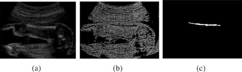 Entropy Based Segmentation Method A Original Image B Result After Download Scientific
