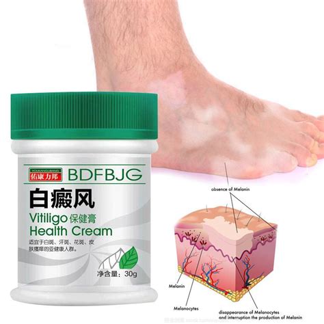 Мазь для лечения белых пятен на теле Крем для усиления пигментации при
