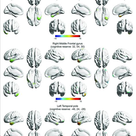Within Group Functional Connectivity Maps Calculated From Seed Areas