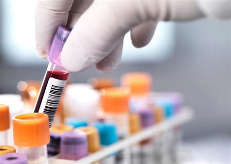 Home Interpath Laboratory Precision Lab Fast Turnaround