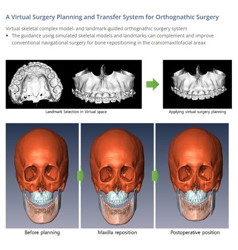 Surgical Navigation System Medical Image Innovation Laboratory