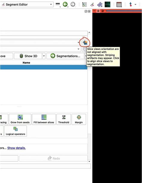 the slice views orientation are not aligned with segmentation support