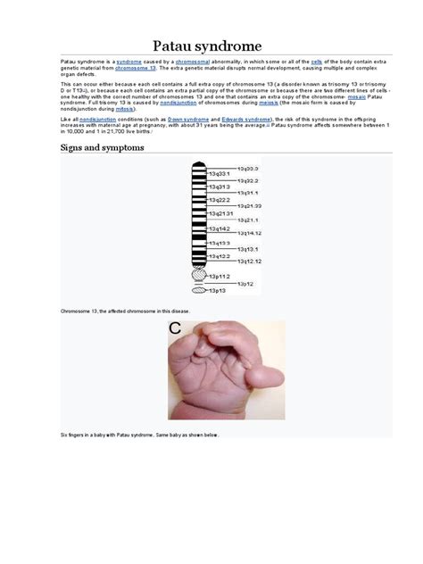 Patau Syndrome Signs And Symptoms Pdf Human Diseases And Disorders