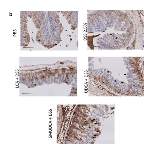 Effects Of Udca Lca And 6‐mudca On Colonic Epithelial Barrier Download Scientific Diagram