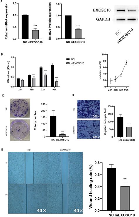 Exosc10 Is A Novel Hepatocellular Carcinoma Prognostic Biomarker A Comprehensive Bioinformatics