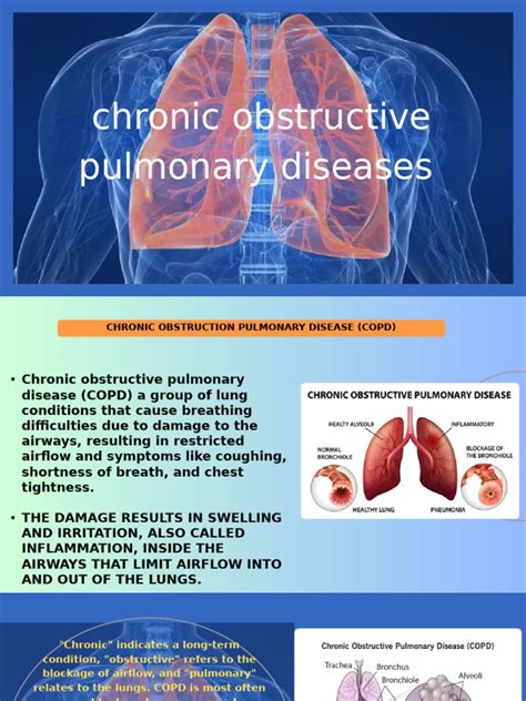 Chronic Obstruction Pulmonary Disease Pdf Chronic Obstructive