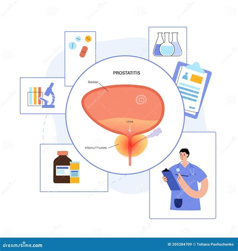 Man Reproducive System Problems Stock Vector Illustration Of Bladder Acute 205384709