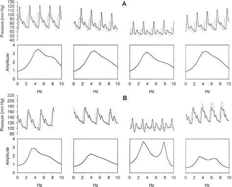 Estimation Of Central Aortic Pressure Waveform By Mathematical Transformation Of Radial
