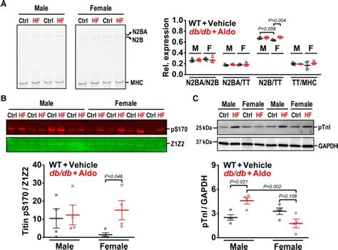 Differential Sex Dependent Susceptibility To Diastolic Dysfunction And Arrhythmia In