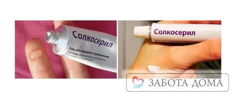 Гель солкосерил от пролежней: применение, показания, аналоги