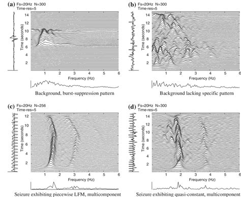 Time Frequency Representations Of Newborn Electroencephalogram EEG Download Scientific