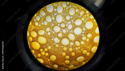 Yellow Human Adipose Tissue Cells Under Microscope Fat Cells With Cholesterol In Close Up